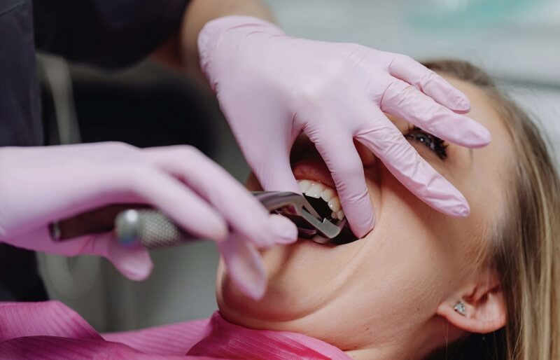 Ciri Infeksi Setelah Cabut Gigi dan Cara Mengatasinya